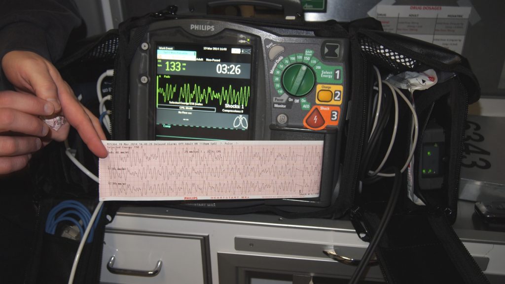New Cardiac Monitors and Defibrillators Provide High-Tech Service to ...